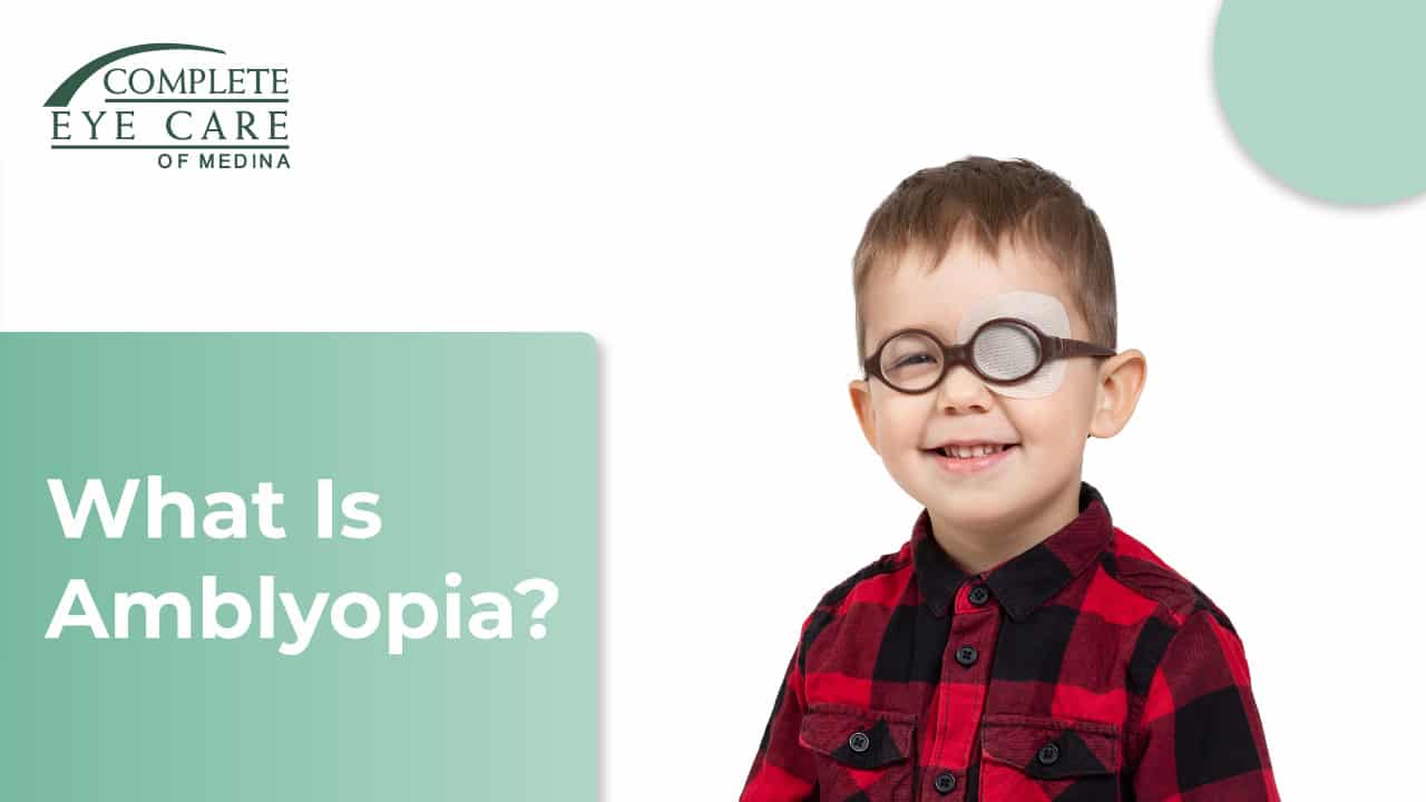 What Is Amblyopia? (Lazy Eye) - Complete Eye Care of Medina What Is Amblyopia? (Lazy Eye) - Complete Eye Care of Medina